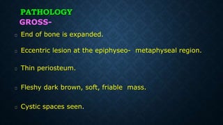 Bone tumour gct | PPT