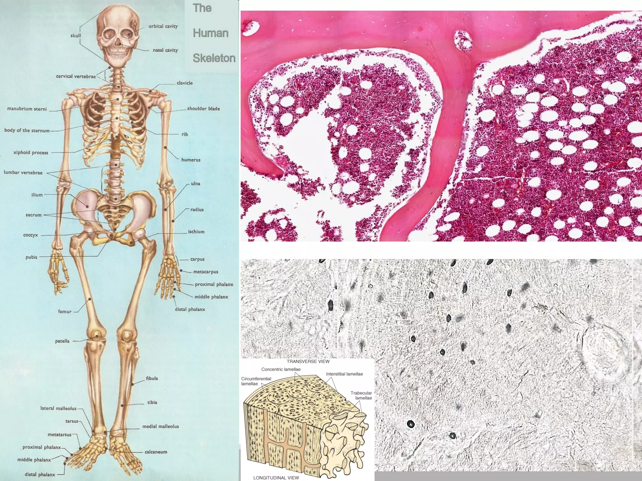 Bone Tumours Ppt