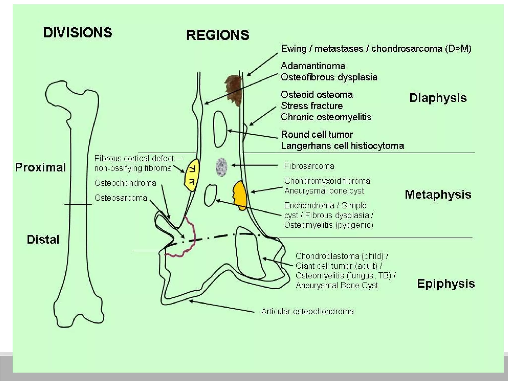 Bone tumours | PPT