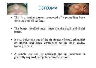 Bone tumours (compiled by Dr. Sanjib Kumar Das) | PDF