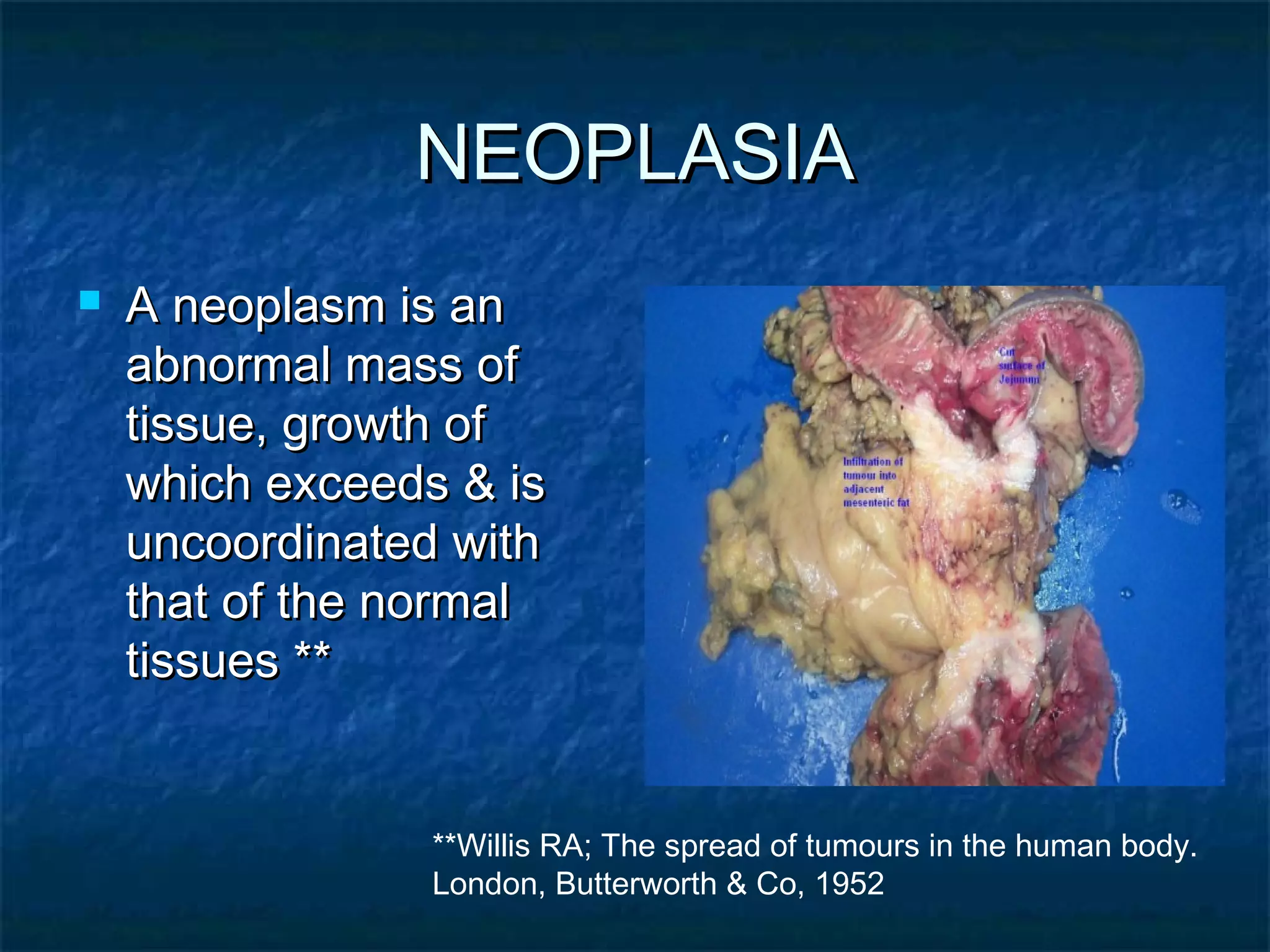 Bone tumours and principles of limb salvage surgery | PPT