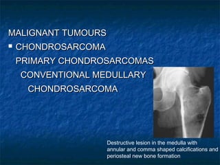 Bone tumours and principles of limb salvage surgery | PPT