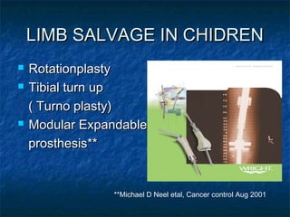 Bone tumours and principles of limb salvage surgery | PPT
