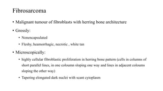 bone tumours BDS and different type of tumor 🤍 | PDF