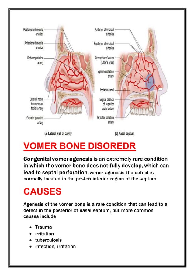 ANATOMY OF VOMER BONE | DOCX | Ear, Nose and Throat Conditions ...