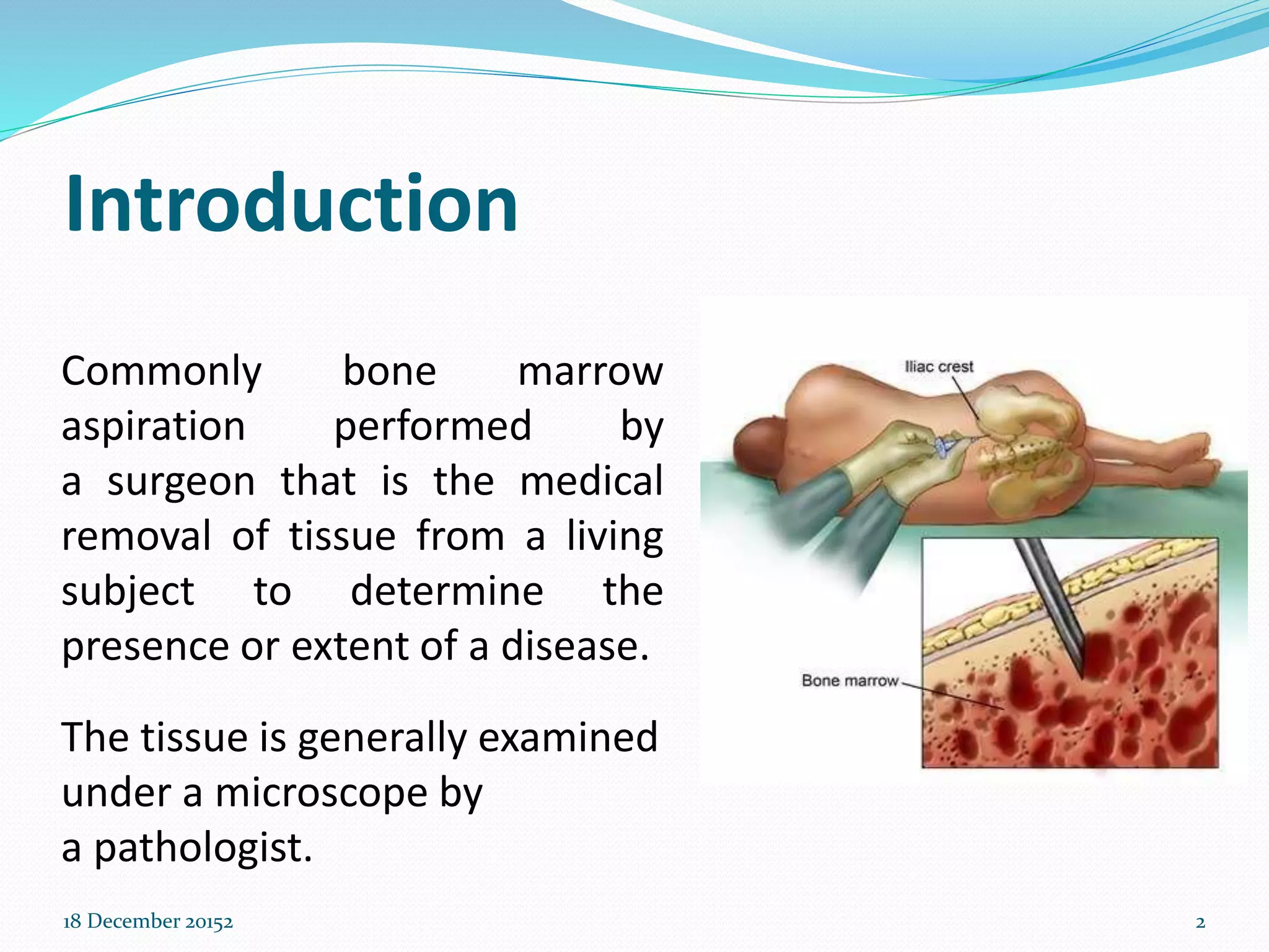Bonne marrow aspiration and intra osseous injection | PPTX | Bone and ...