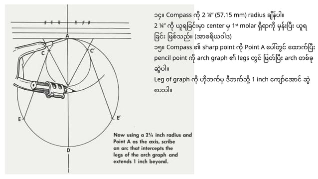 Bonwill-Hawley Chart formation in orthodontics.pptx