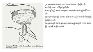 Bonwill-Hawley Chart formation in orthodontics.pptx