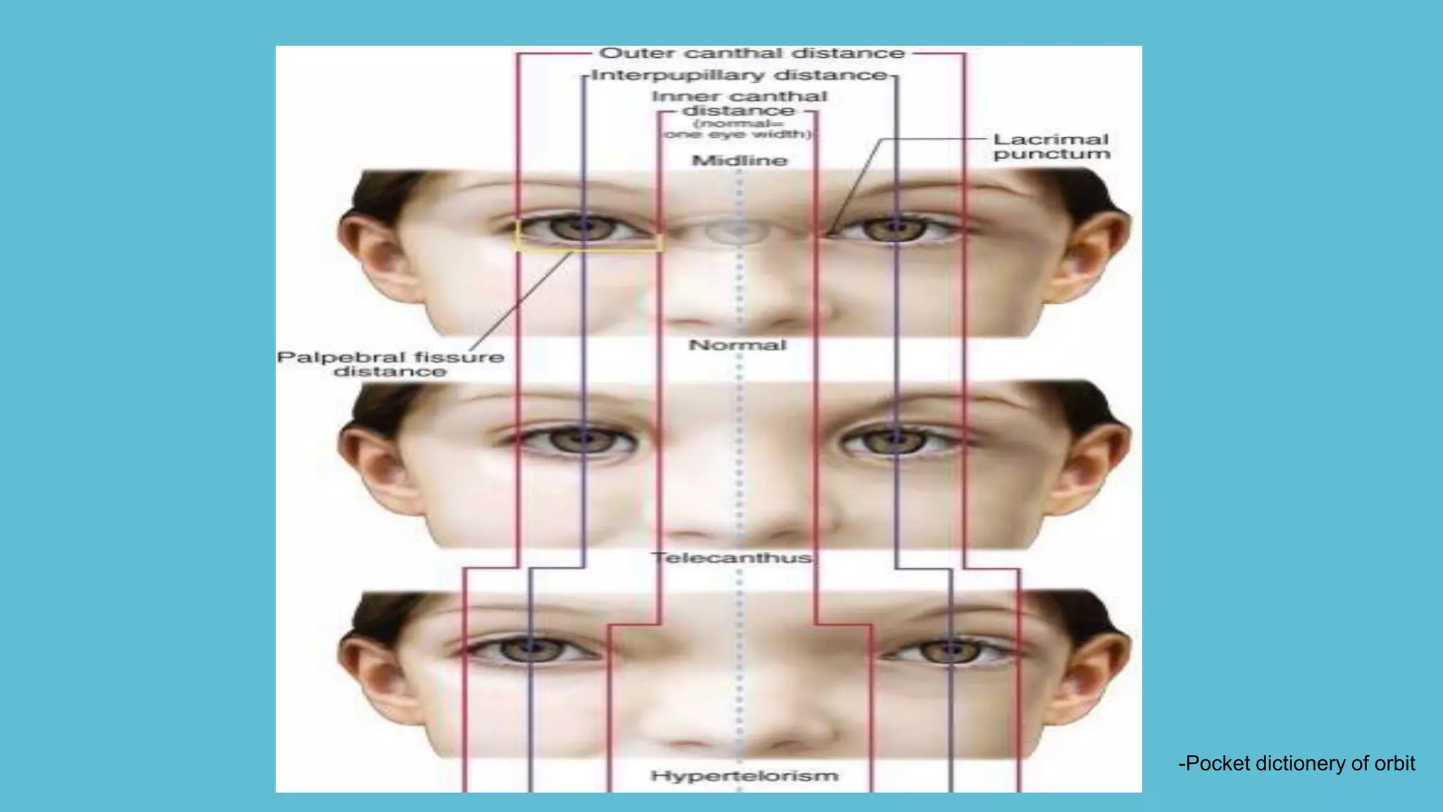 Anatomy Of The Bony Orbit Pptx
