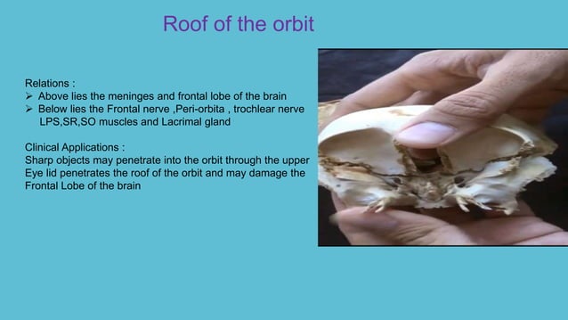 Anatomy of the Bony orbit | PPTX
