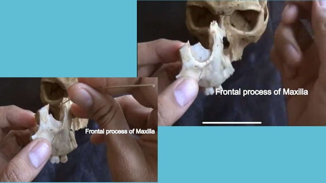 Anatomy of the Bony orbit | PPTX