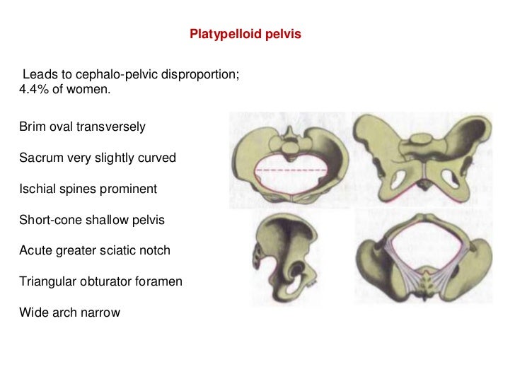 Bony pelvis