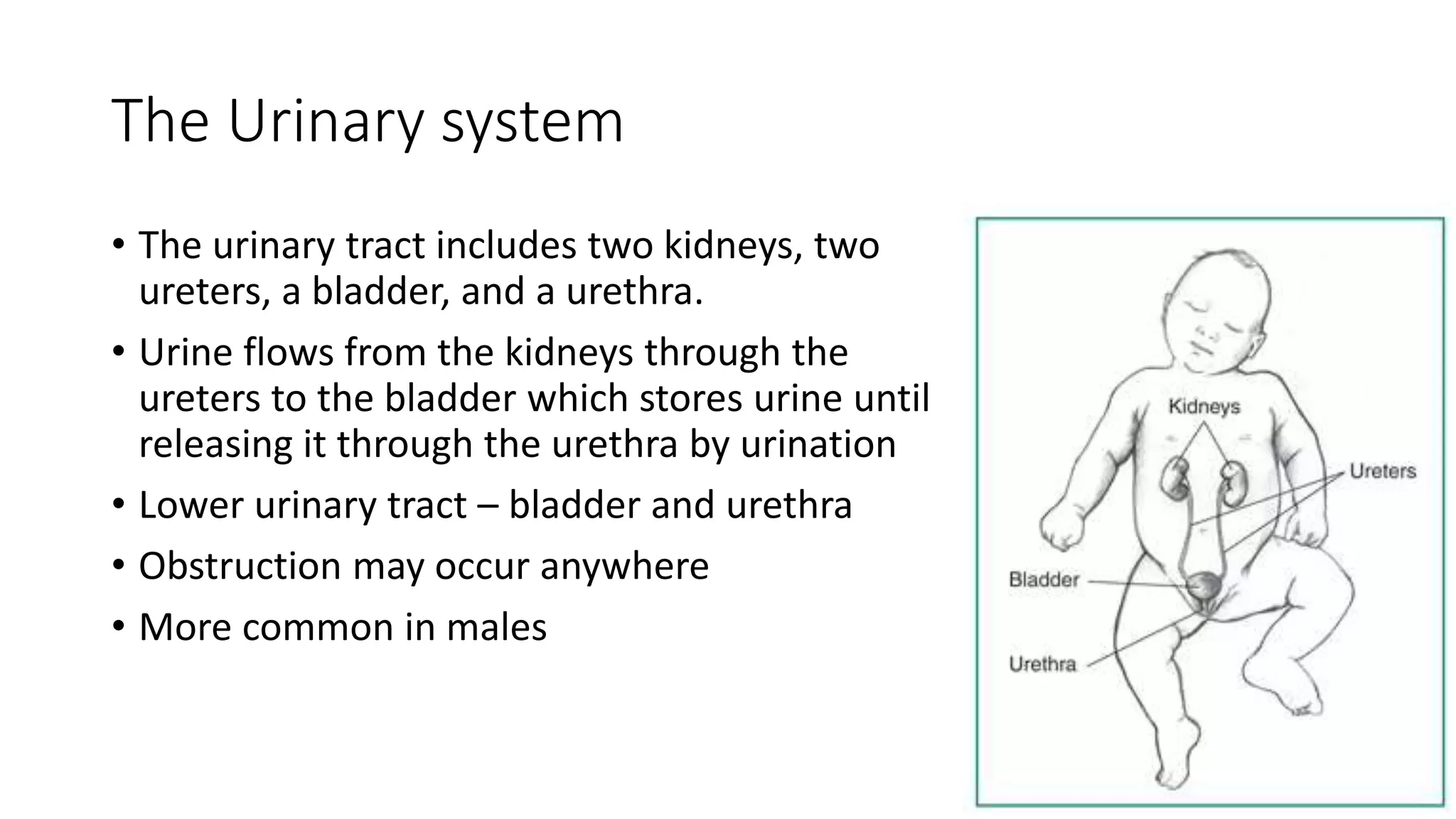 Bladder outlet obstruction in children | PPTX