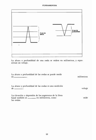 EKG DUBIN | PDF
