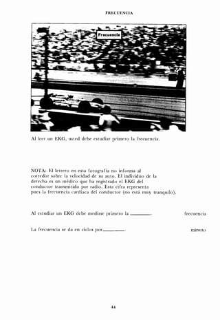 EKG DUBIN | PDF