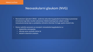 Božo Kovačević - Sekundarni glaukom.pptx