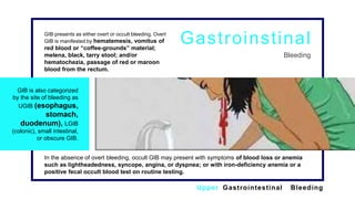 UPPER GI BLEEDING | PPTX