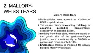 UPPER GI BLEEDING | PPTX