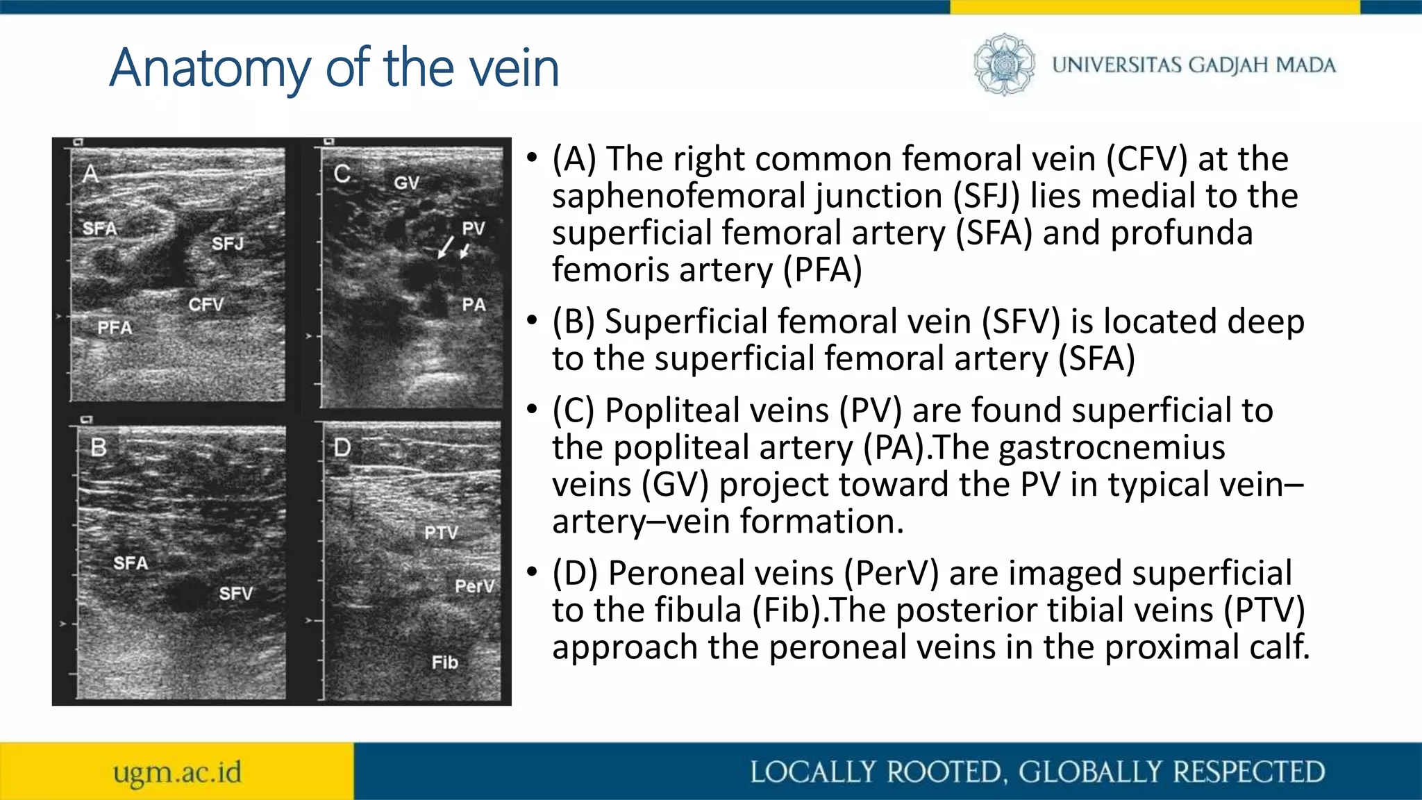 Book reading doppler vena.pptx
