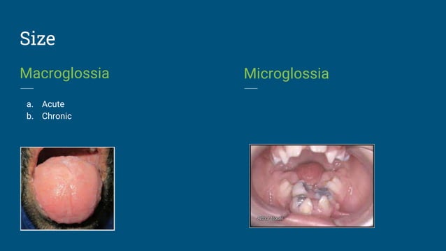 tongue diagnosis | PPTX