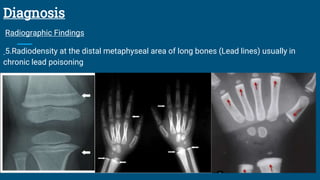 Lead poisoning, clinical examination, diagnosis | PPTX