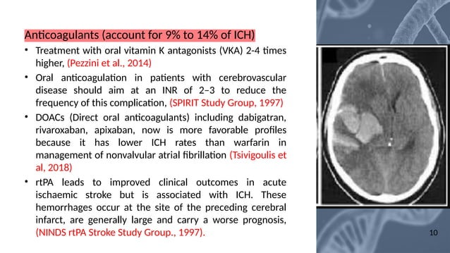 Book Rev Intracerebral Hemorrhage.pptx... | PPT