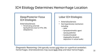 Book Rev Intracerebral Hemorrhage.pptx... | PPT
