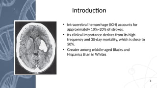 Book Rev Intracerebral Hemorrhage.pptx... | PPT