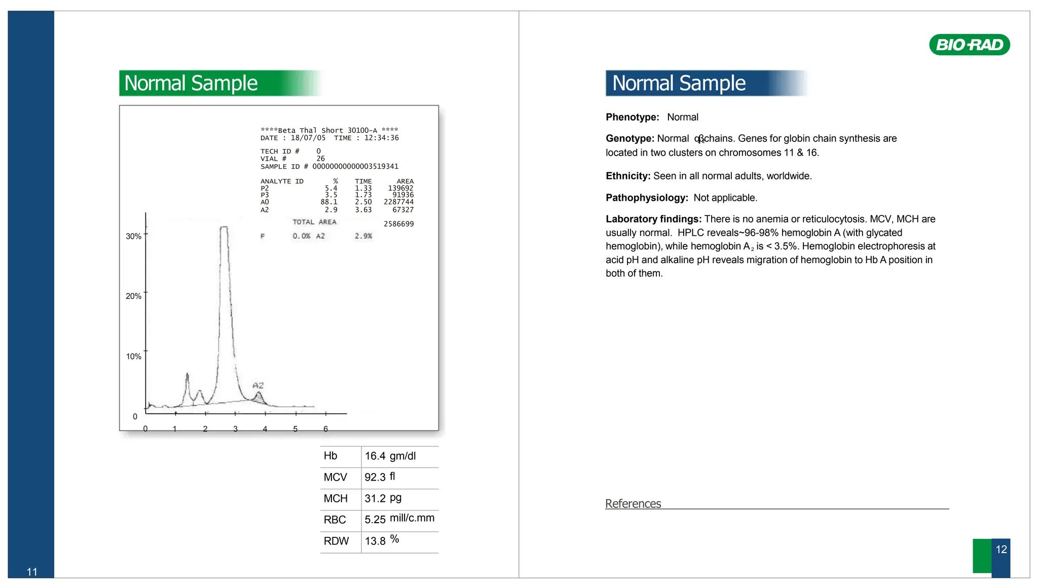 HPLC Hemoglobinopathies patterns atlas HPLC | PPTX