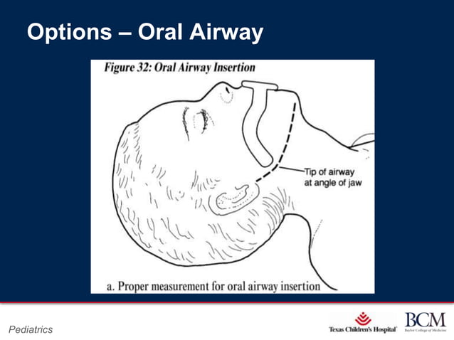 2013 Pediatric Fellows Boot Camp_Adjuncts BMV & LMA | PPT