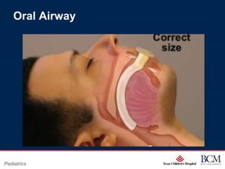 2013 Pediatric Fellows Boot Camp_Adjuncts BMV & LMA | PPT