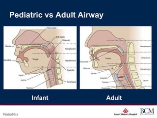 2013 Pediatric Fellows Boot Camp_Adjuncts BMV & LMA | PPT