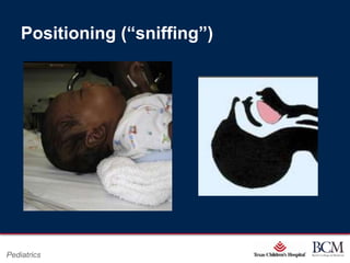 2013 Pediatric Fellows Boot Camp_Adjuncts BMV & LMA | PPT | Free Download