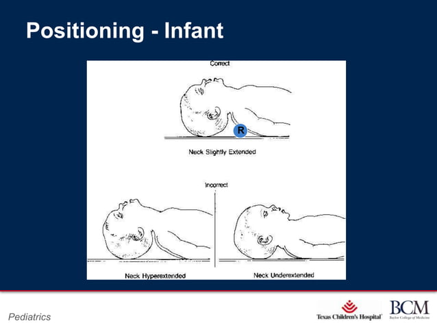 2013 Pediatric Fellows Boot Camp_Adjuncts BMV & LMA | PPT
