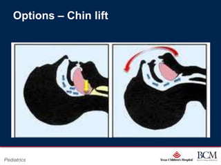 2013 Pediatric Fellows Boot Camp_Adjuncts BMV & LMA | PPT