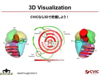 Bootcamp cvic perfusion | PPTX