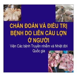 béo phì và suy dinh dưỡng.pdf | Free Download