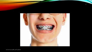 Borderline extraction cases | PPT