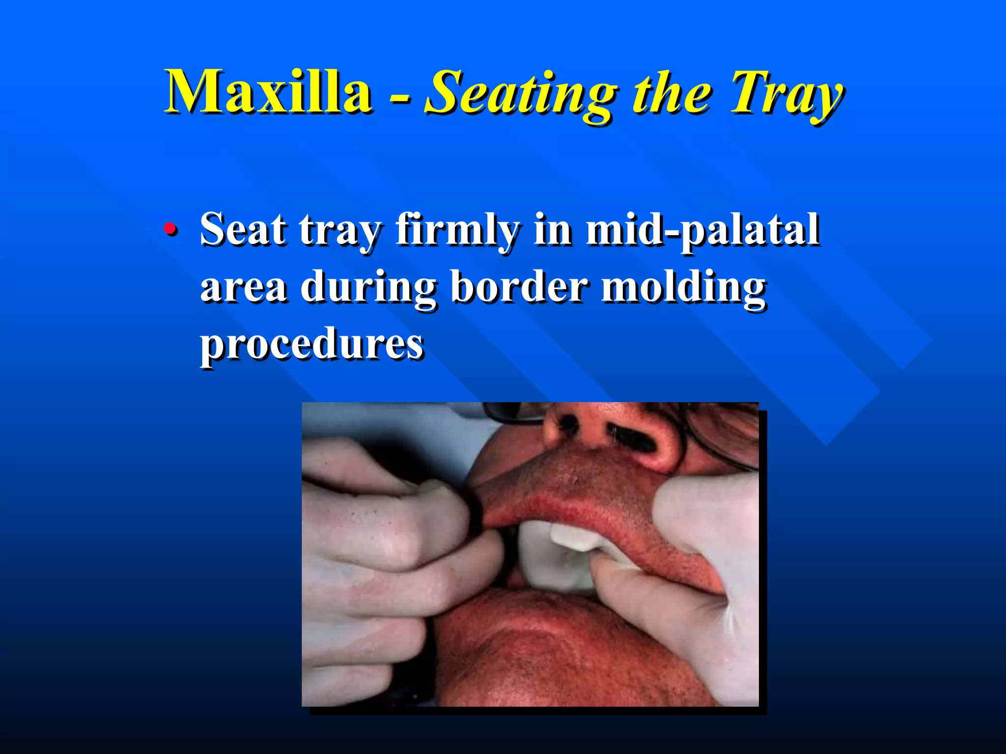 Border Molding.ppt