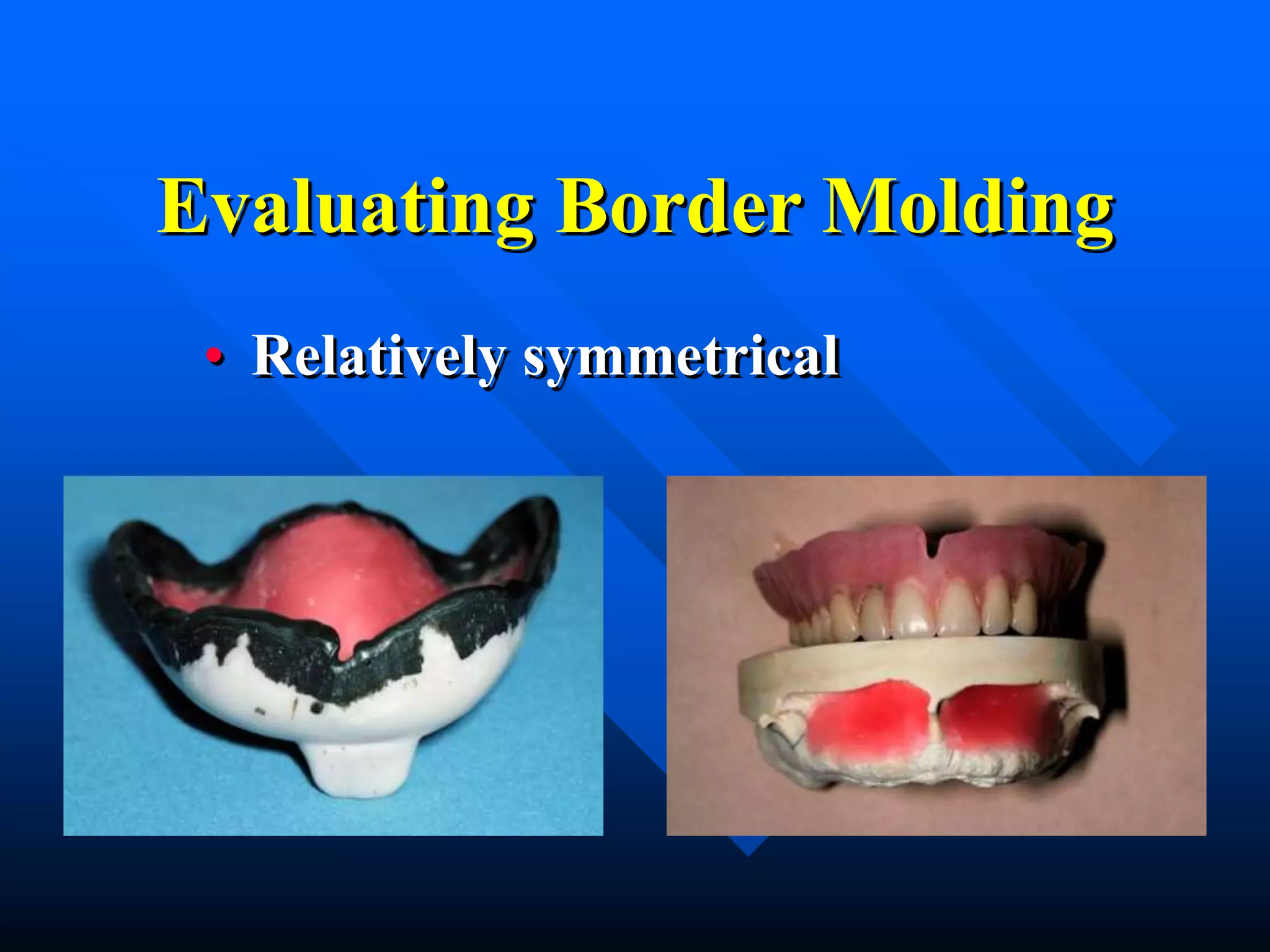 Border Molding.ppt