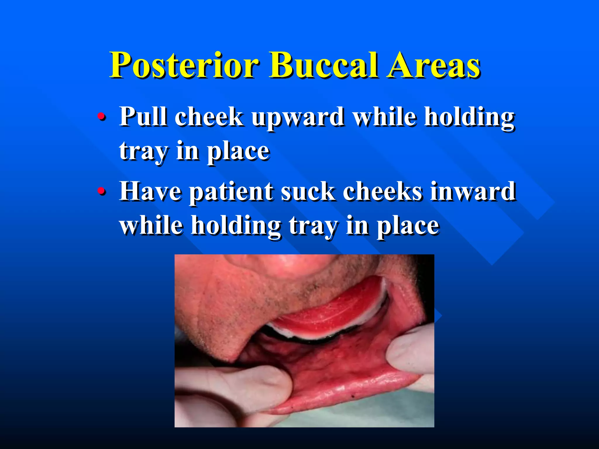 Border Molding.ppt
