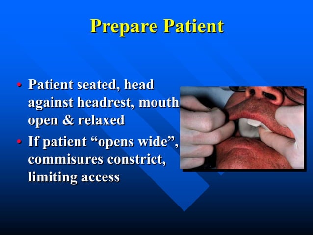Border Molding.ppt | Dental Health | Diseases and Conditions