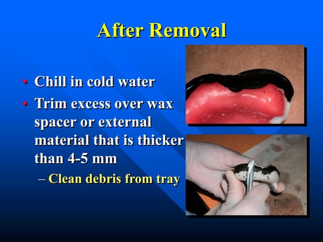 Border Molding.ppt | Dental Health | Diseases and Conditions