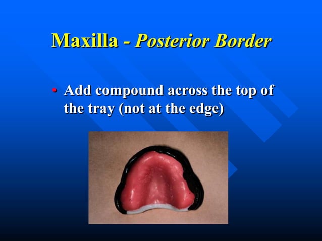 Border Molding.ppt | Dental Health | Diseases and Conditions
