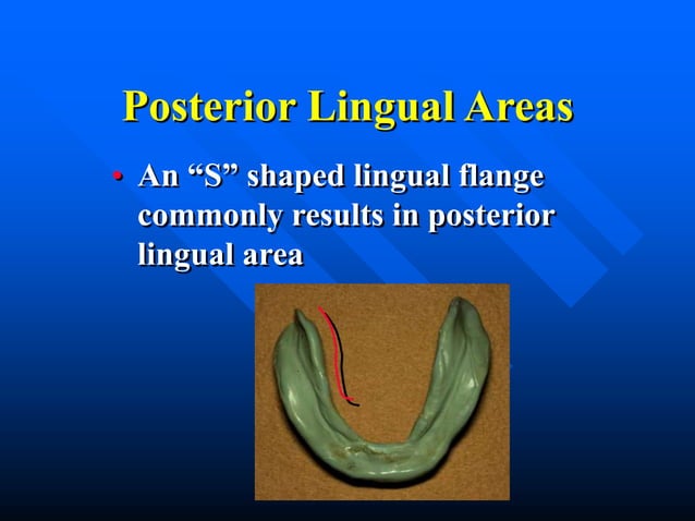 Border Molding.ppt | Dental Health | Diseases and Conditions