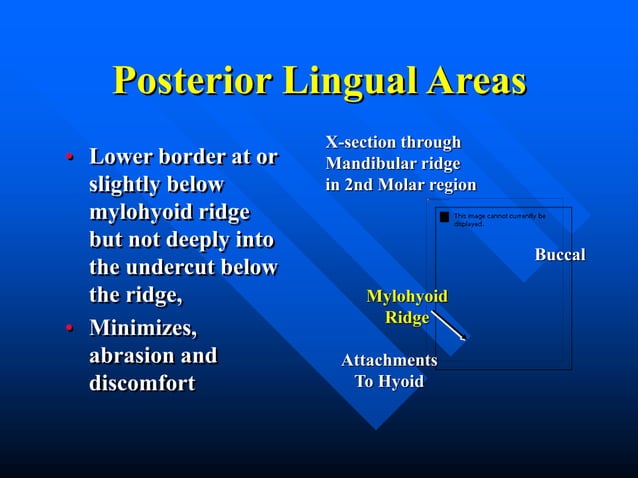 Border Molding.ppt | Dental Health | Diseases and Conditions