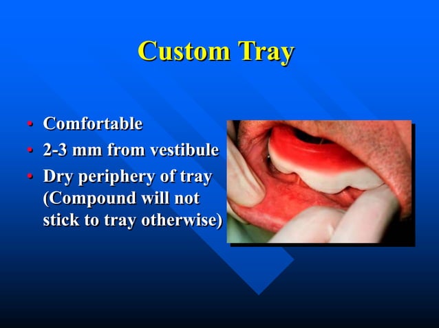 Border Molding.ppt | Dental Health | Diseases and Conditions