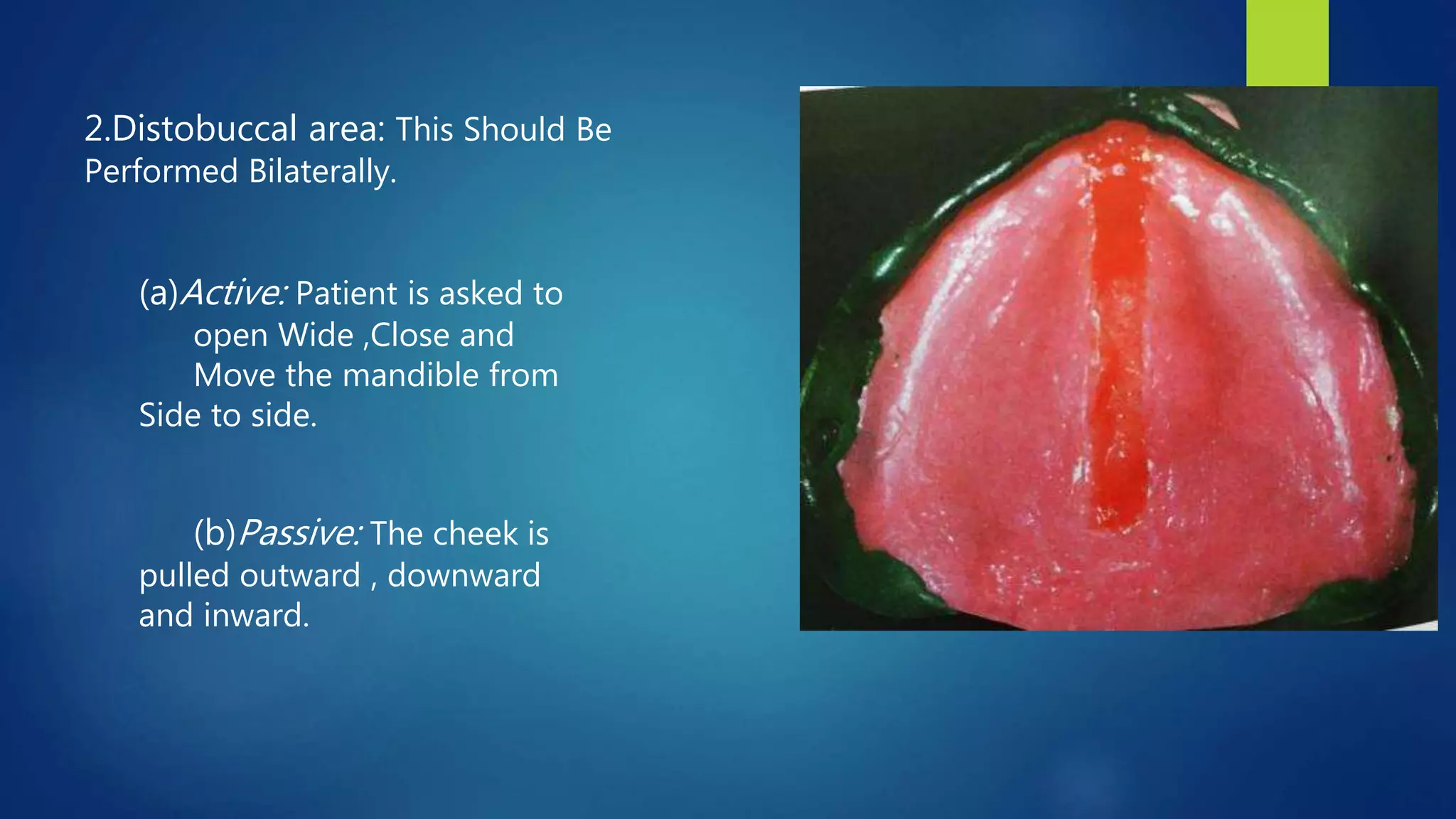 Border Moulding in Complete Denture Prosthesis | PPTX
