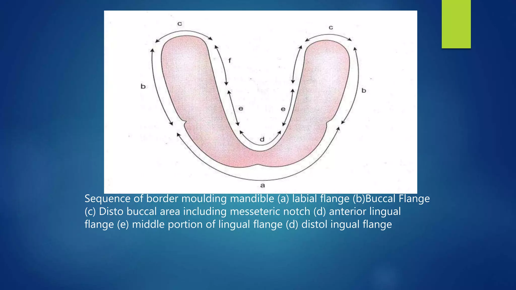 Border Moulding in Complete Denture Prosthesis | PPTX