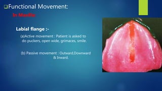 Border Moulding in Complete Denture Prosthesis | PPTX